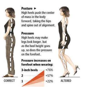 7 Common Posture Mistake by Women And How To Correct Them – Bellisima ...